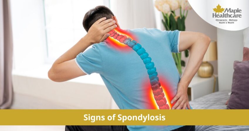 Spondylosis: Types, Diagnosis and Treatment - Maple Healthcare Vietnam